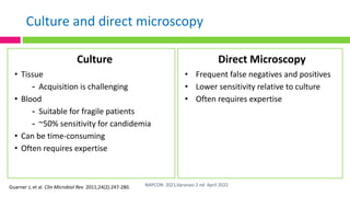 Candidiasis NAPCON.pptx