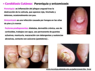 CANDIDIASIS PROFUNDA Y SISTÉMICA.pptx