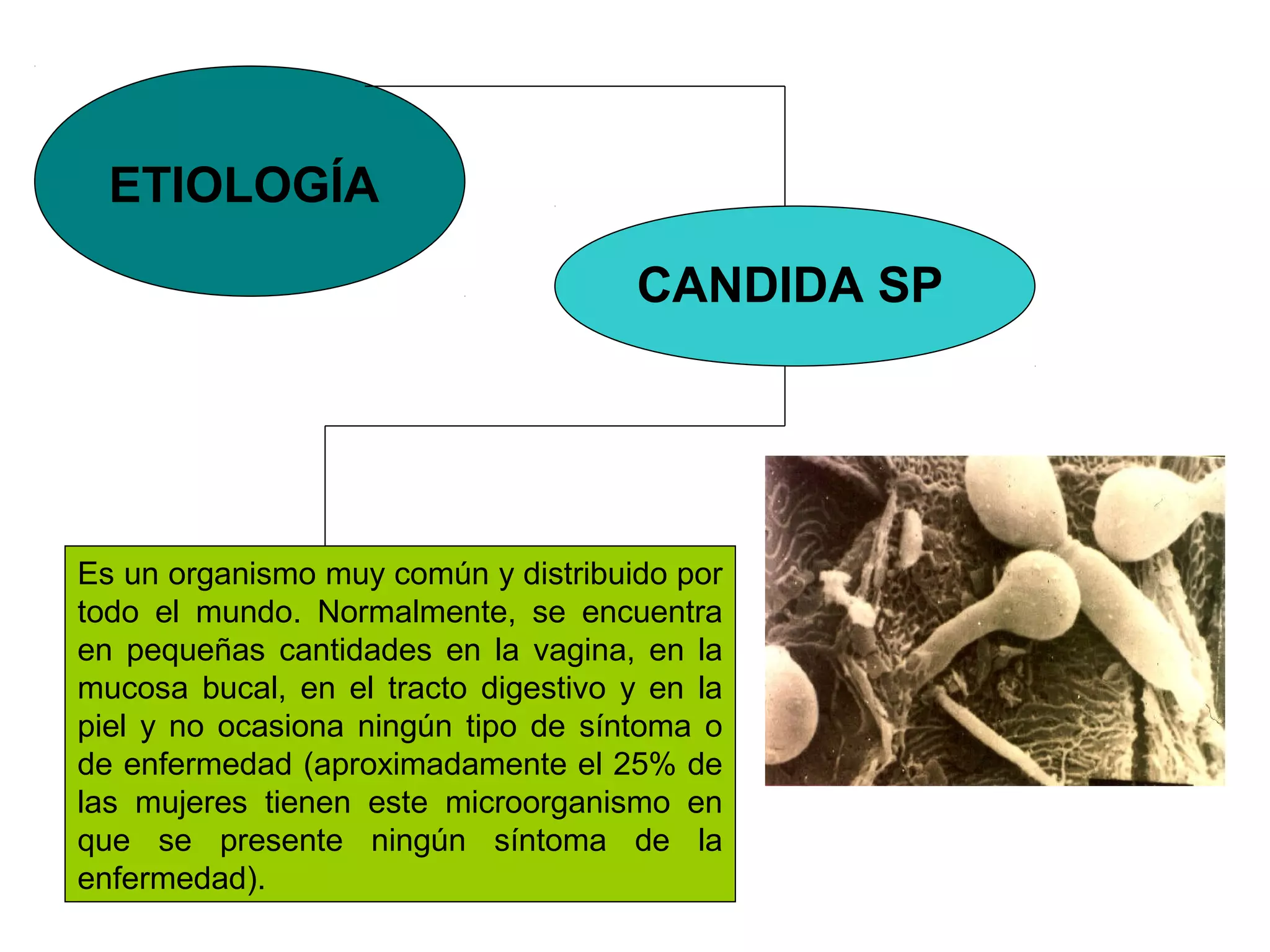 Candidiasis | PPT