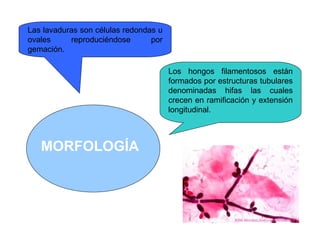 Candidiasis | PPT