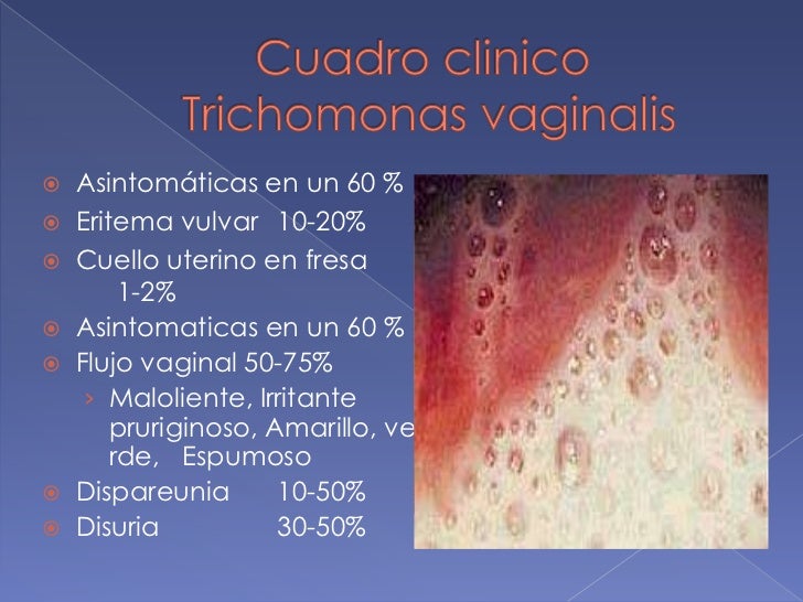 Candidiasis y trichomonas