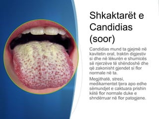 Candidias (soor) te të rriturit | PPT