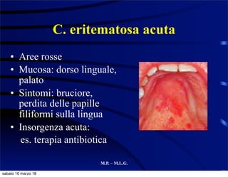 Candidosi Atrofica Cronica