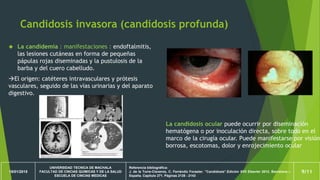 CANDIDIASIS | PPTX