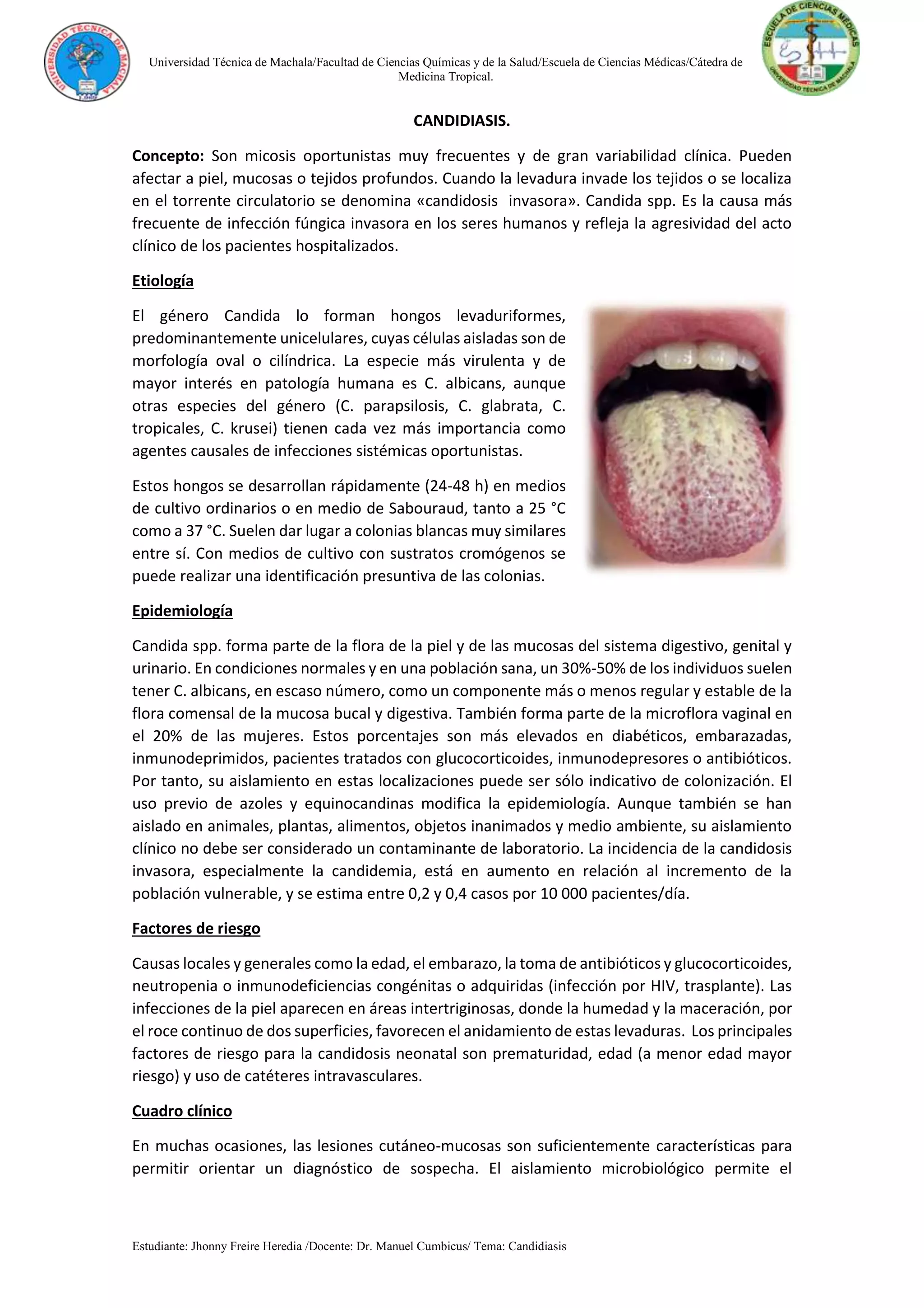 CANDIDIASIS | DOCX