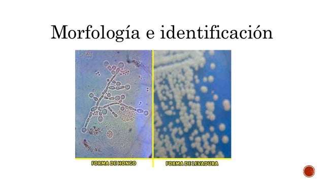 Candidosis, Candida Albicans