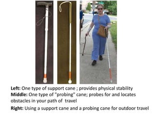 Cane: A_mobility_aid | PPTX