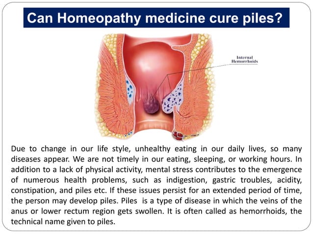 Can Homeopathy medicine cure piles.pptx