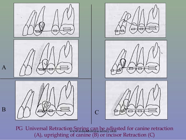 Canine retraction /certified fixed orthodontic courses by Indian dent…