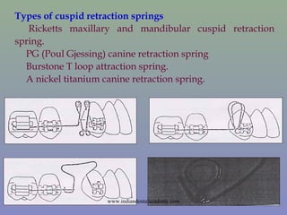 Types Of Retractions