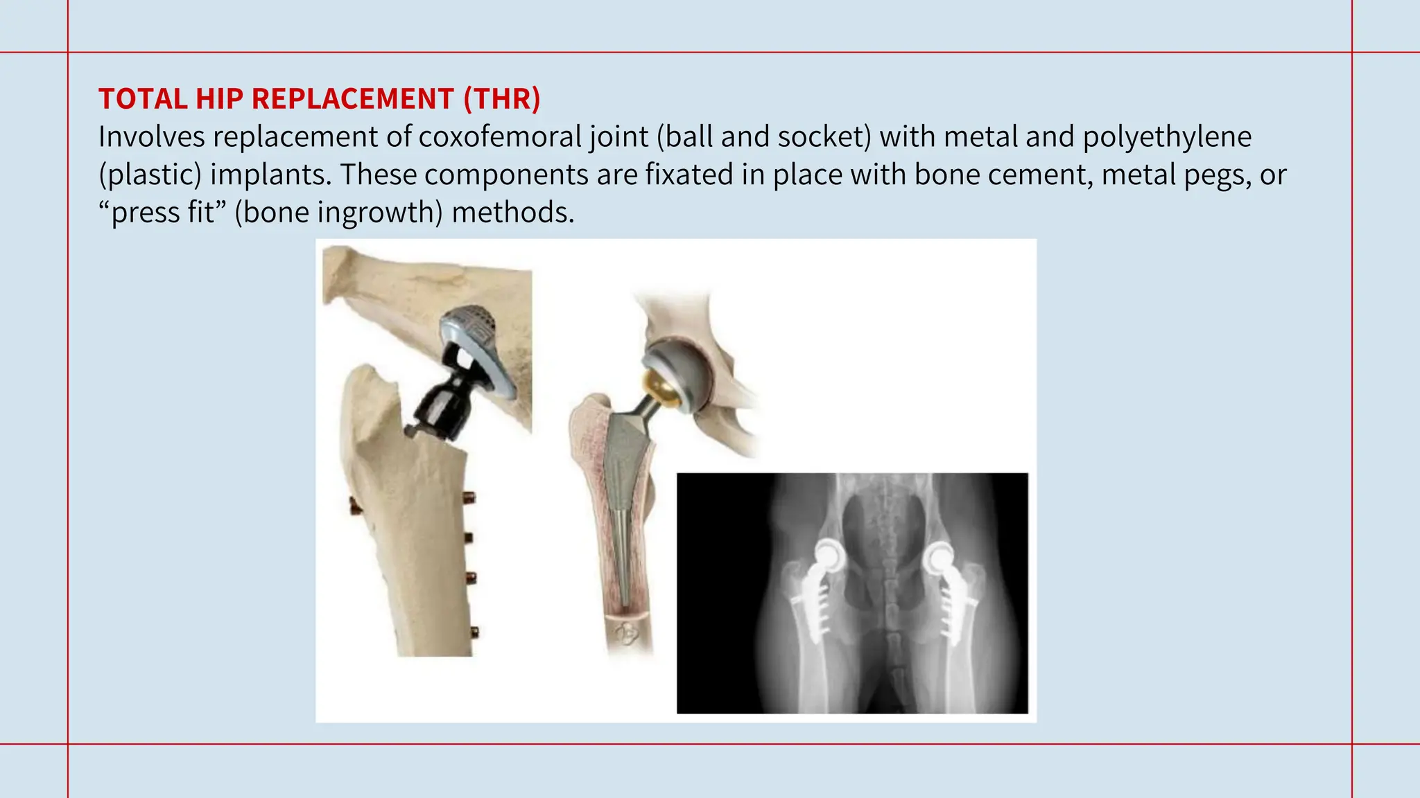 Canine hip dysplasia.pptx
