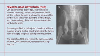 Canine hip dysplasia.pptx