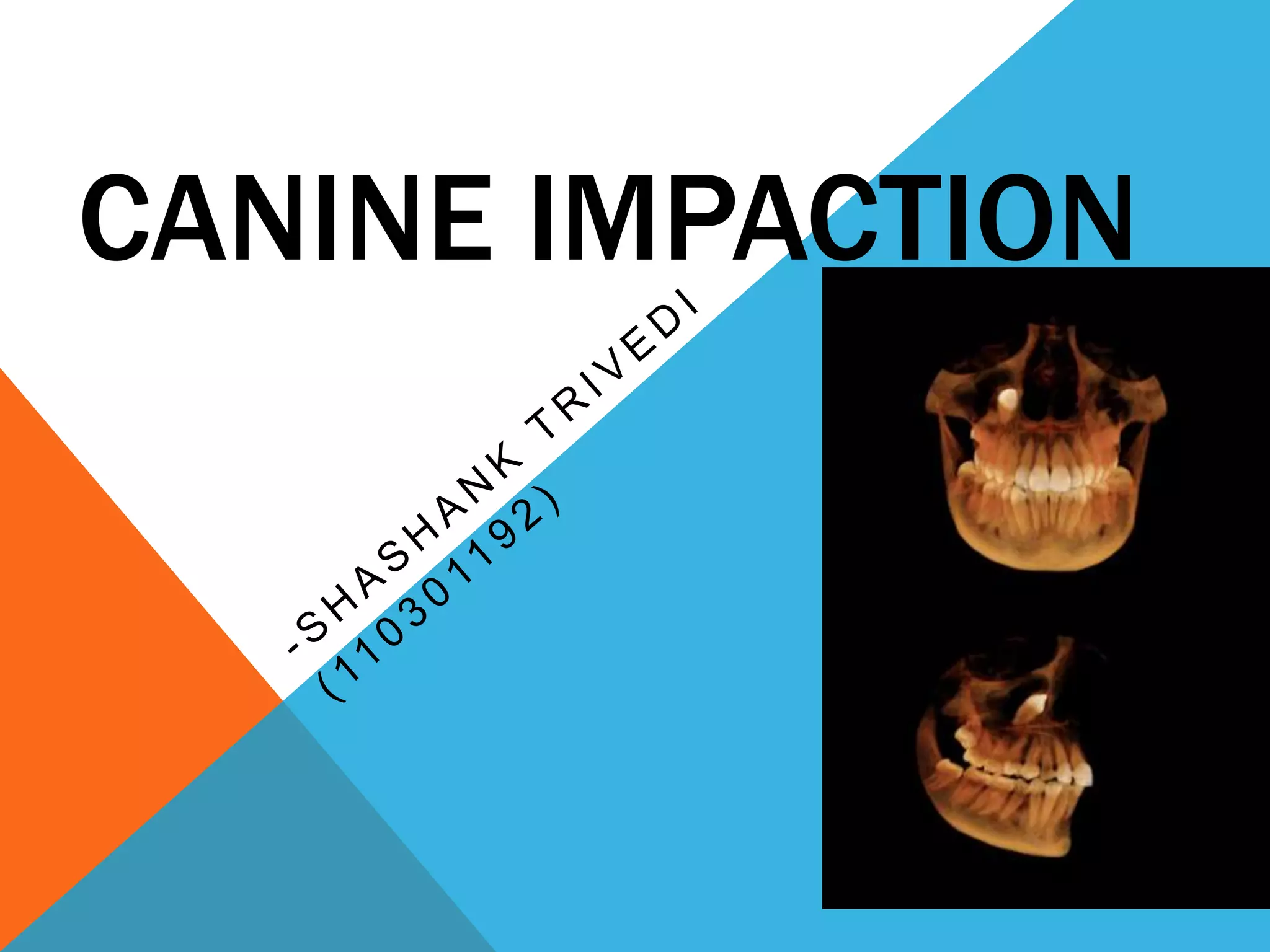 Canine impaction | PPTX