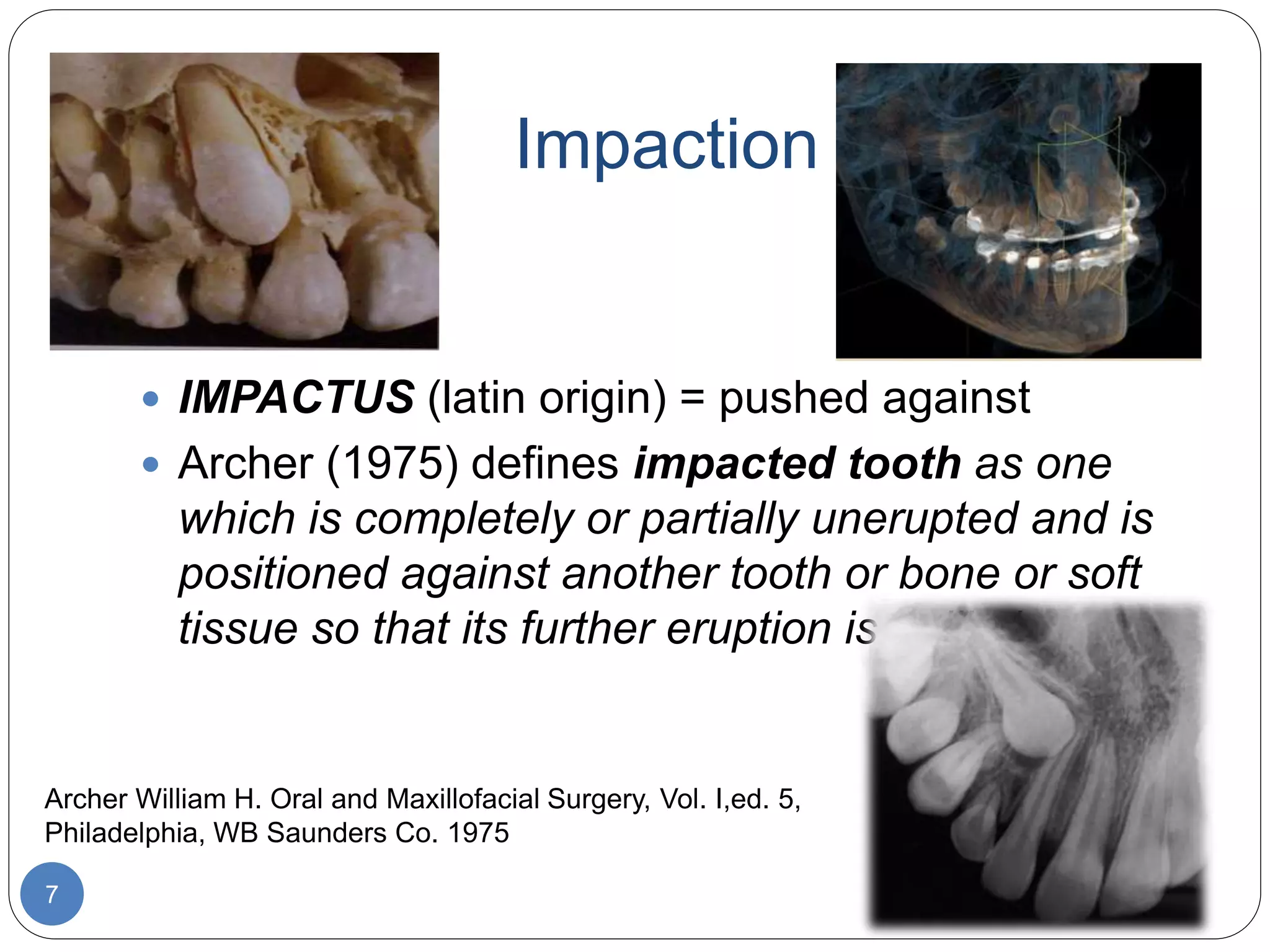 Canine Impaction and Its Importance in Orthodontics | PPTX