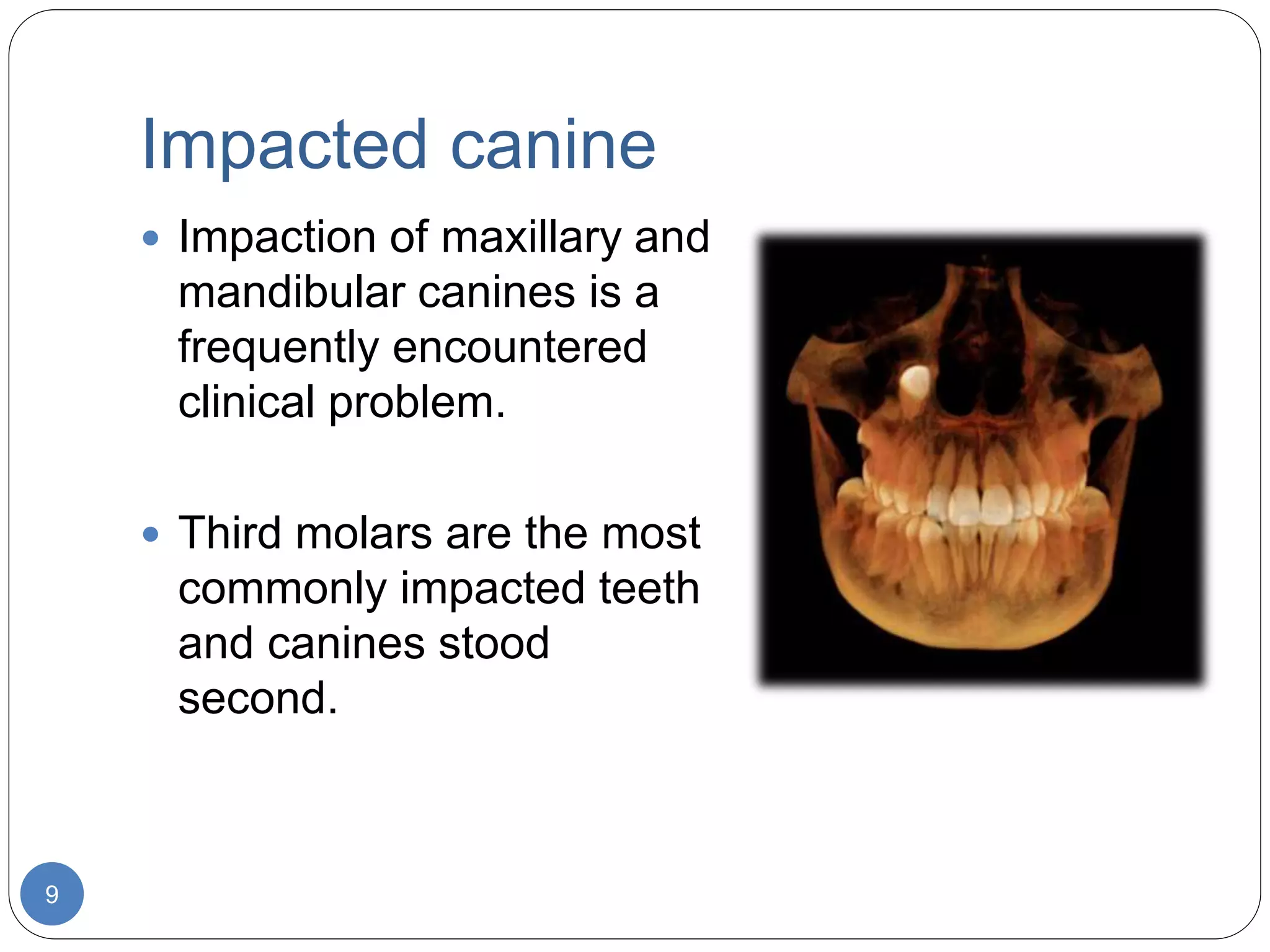 Canine Impaction and Its Importance in Orthodontics | PPTX