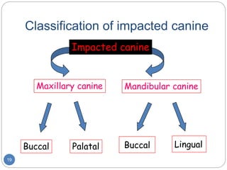 Canine Impaction and Its Importance in Orthodontics | PPTX