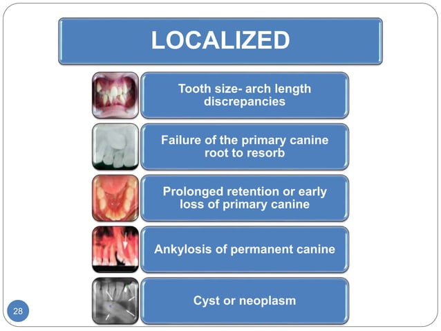 Canine Impaction and Its Importance in Orthodontics | PPTX | Dental ...