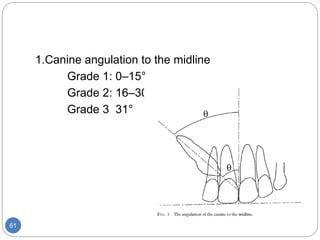 Canine Impaction and Its Importance in Orthodontics | PPTX