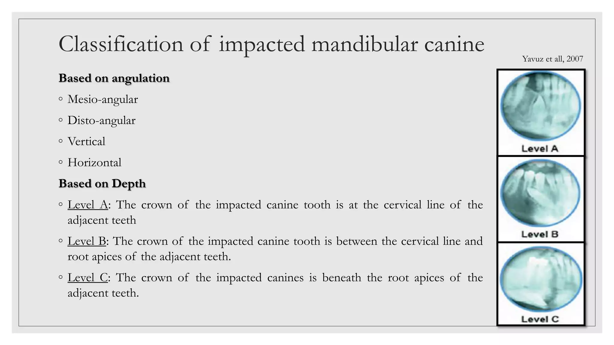 Canine impaction | PPTX