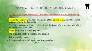 Canine impaction maxillary teeth part 2 | PPTX
