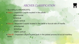 Canine impaction maxillary teeth part 2 | PPT