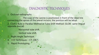Canine impaction maxillary teeth part 2 | PPT