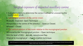Canine impaction maxillary teeth part 2 | PPT