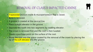 Canine impaction maxillary teeth part 2 | PPT