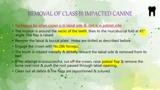 Canine impaction maxillary teeth part 2 | PPT