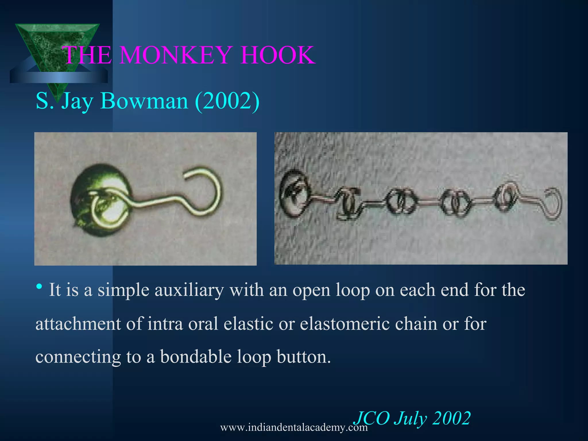 Canine impaction 1 | PPT