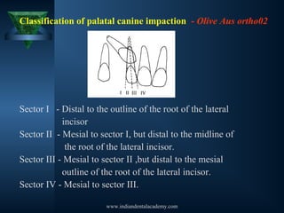 Canine impaction 1 | PPT