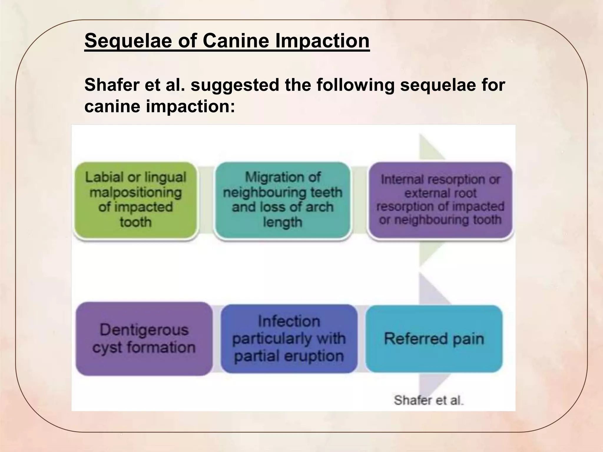 CANINE IMPACTION 1.pptx