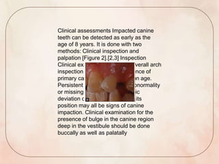 CANINE IMPACTION 1.pptx
