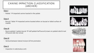 CANINE IMPACTION AND ITS CLINICAL CONSIDERATIONS.pptx | Dental Health ...