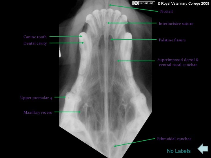 Nasal Turbinates Xray
