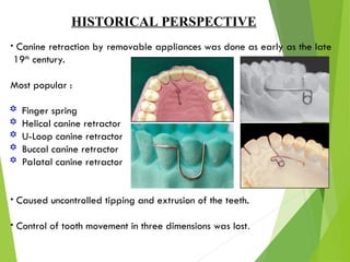 Comprehensive Overview of Canine Retraction in Orthodontics ...