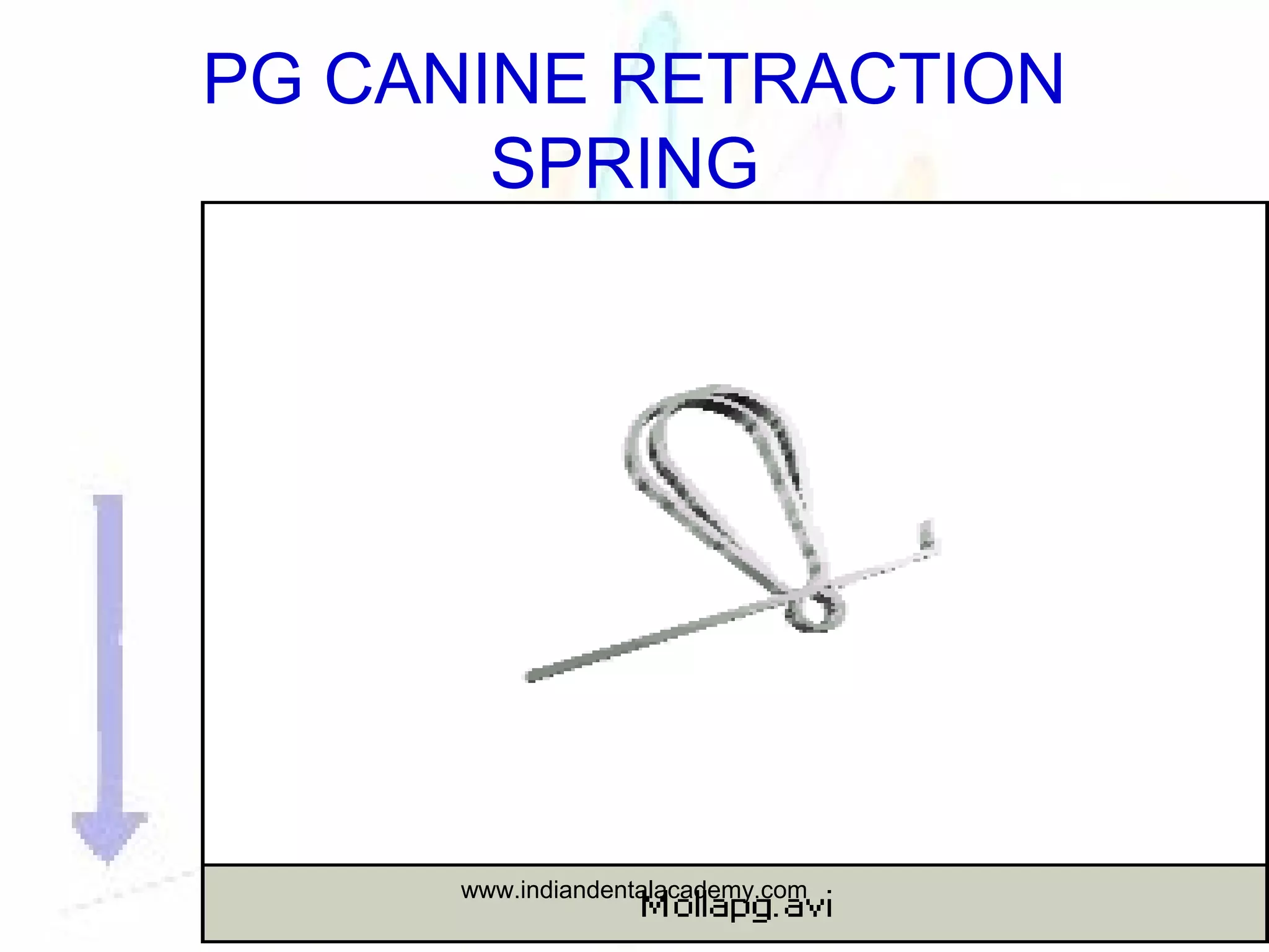 Canine retraction by frictionless mechanics | PPT
