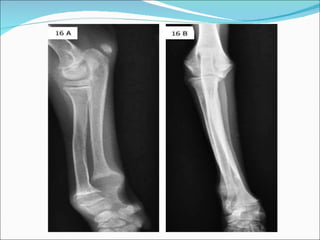 Rickets In Dogs