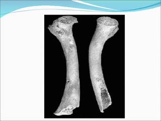 Canine Rickets | PPT