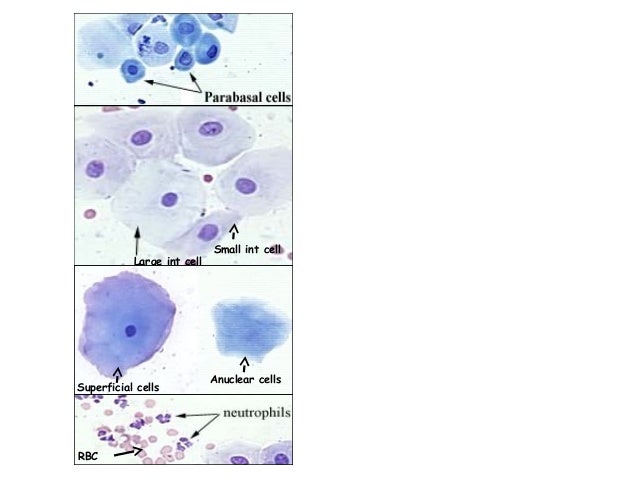 Canine vaginal cytology1