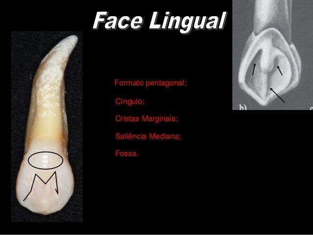 Caninos Superiores e Inferiores