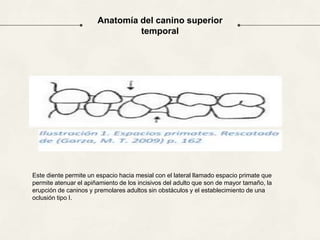 Anatomía Dental II - Canino Deciduo | PPTX