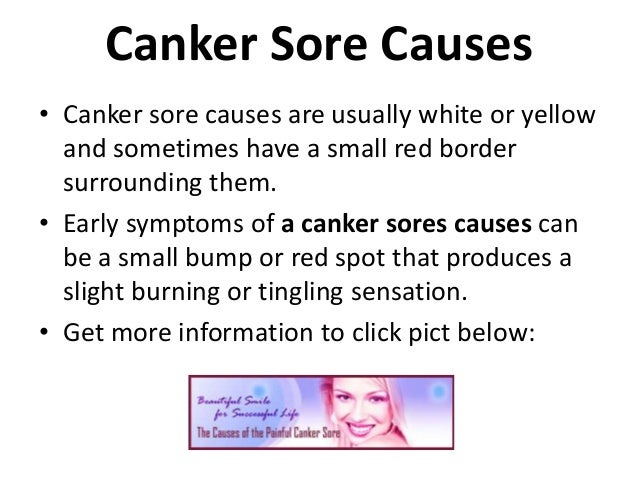 Canker Sore Causes