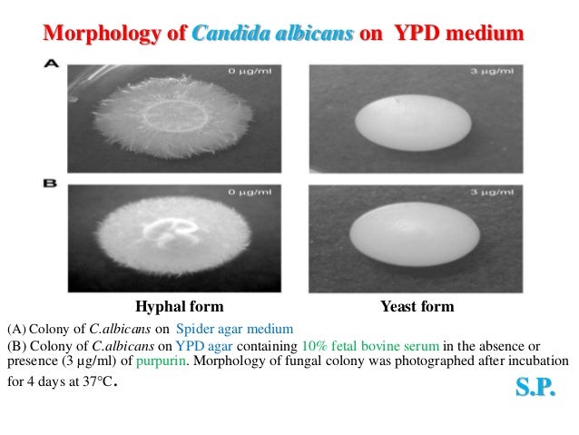 Morphology of Candida albicans on Spider and YPD medium