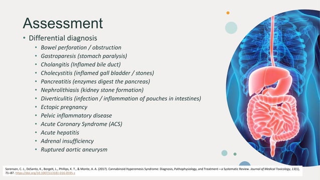Cannabinoid Hyperemesis Syndrome.pptx | Substance Abuse | Diseases and ...