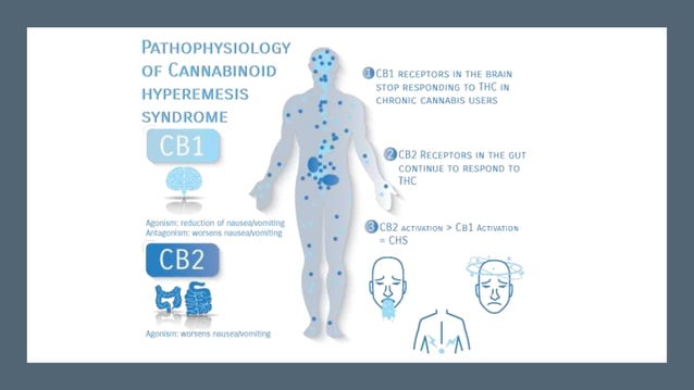 Cannabinoid Hyperemesis Syndrome Final.pptx | Digestive Disorders ...