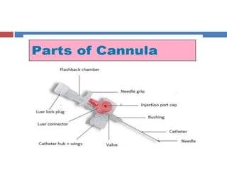 cannula.pptx