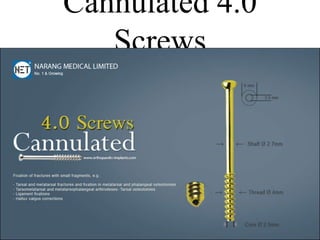 Cannulated screws | PPTX