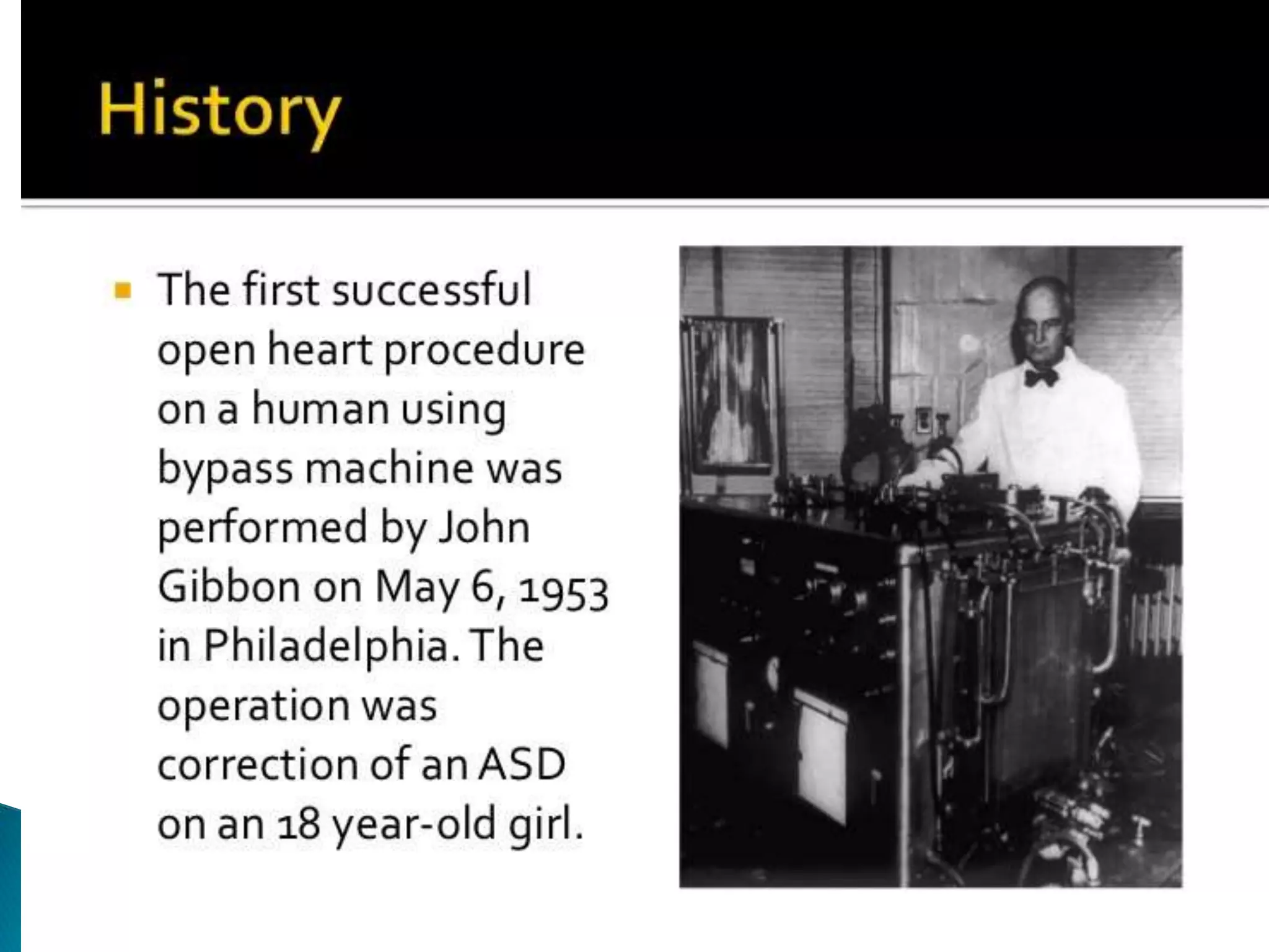 Cannulation and cardiopulmonary bypass. | PPTX