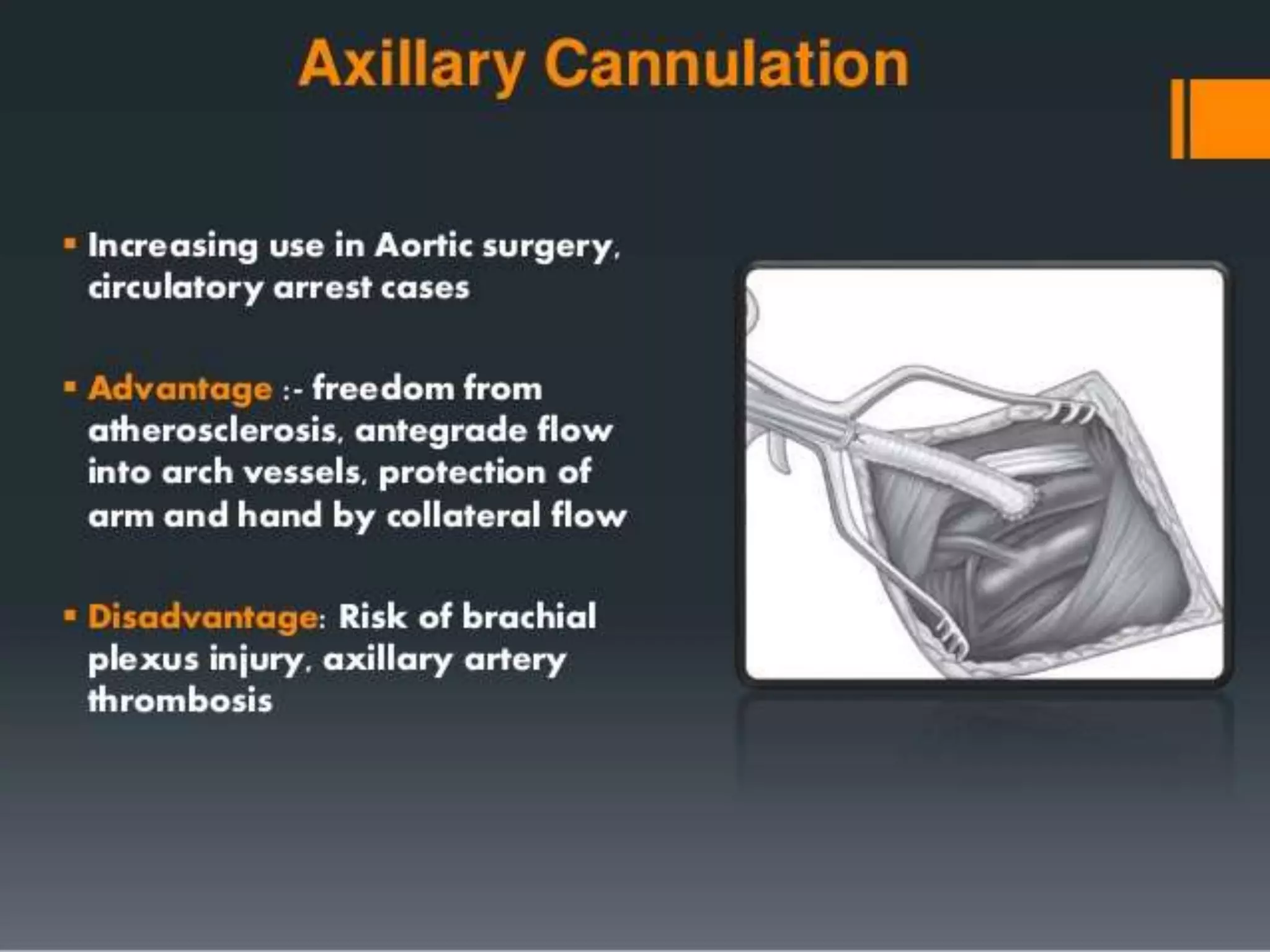 Cannulation and cardiopulmonary bypass. | PPTX